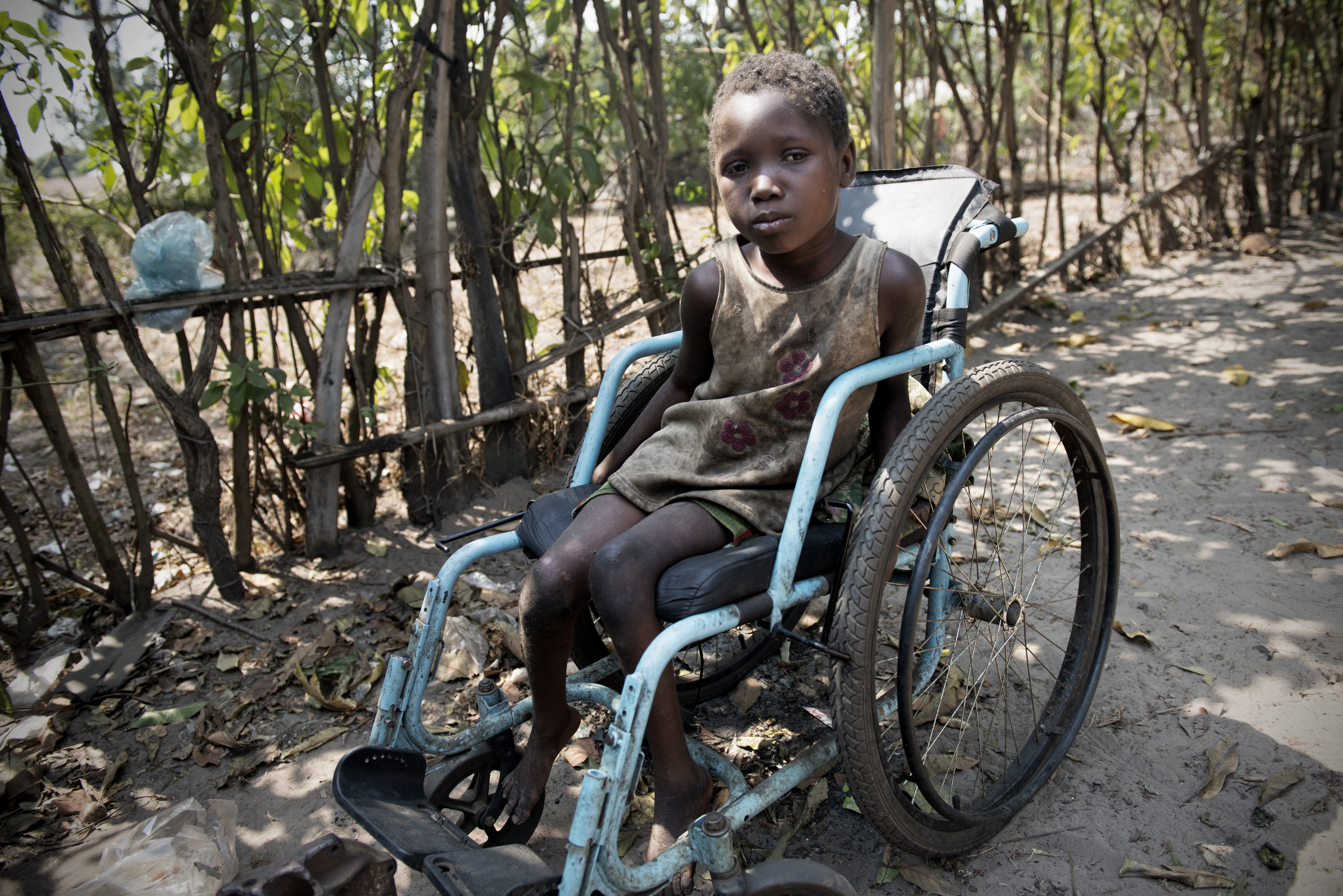 Cassava and Konzo, the Crippling Disease | Pulitzer Center