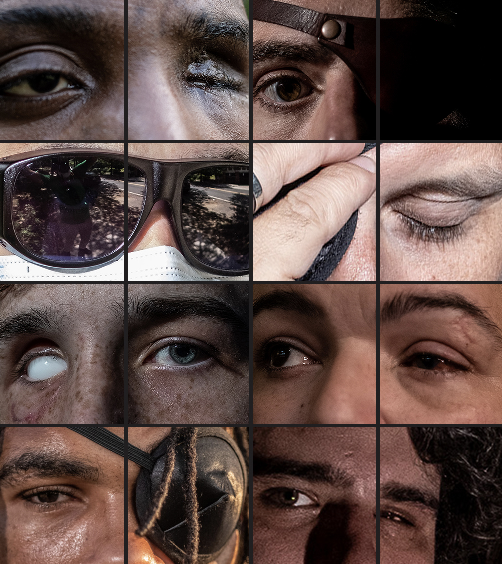 Less Lethal Weapons Brought into Focus | Pulitzer Center