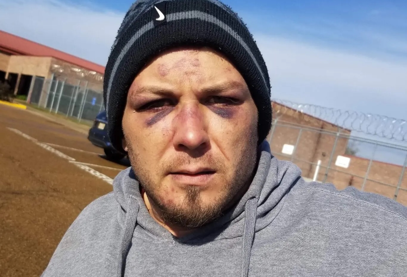 Videos Show Guards at Mississippi Jail Mocking Intellectually Disabled ...