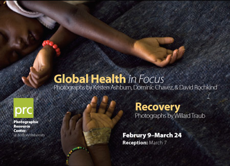 Exhibit Features David Rochkind's TB Photos | Pulitzer Center