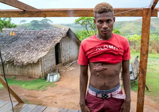 World War II Is Still Killing People in the Solomon Islands | Pulitzer ...